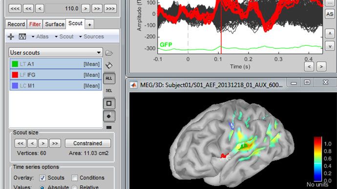 Brainstorm A Matlab Based Open Source Application For Advanced Megeeg Data Processing And